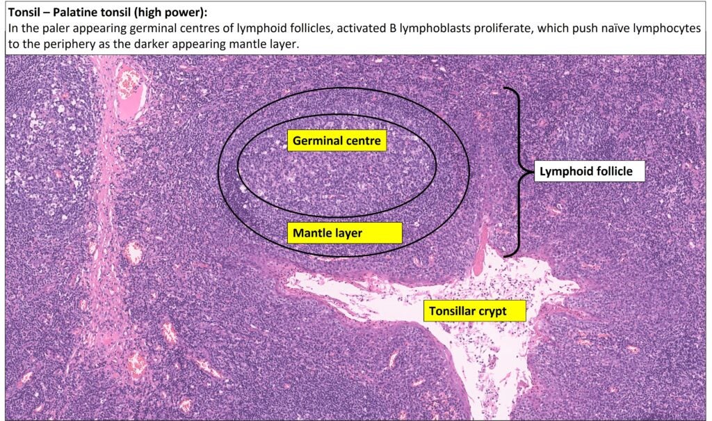 Tonsil – Normal Histology – NUS Pathweb :: NUS Pathweb