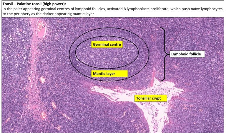 Tonsil – Normal Histology – NUS Pathweb :: NUS Pathweb
