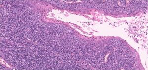 Tonsil – Normal Histology – NUS Pathweb :: NUS Pathweb