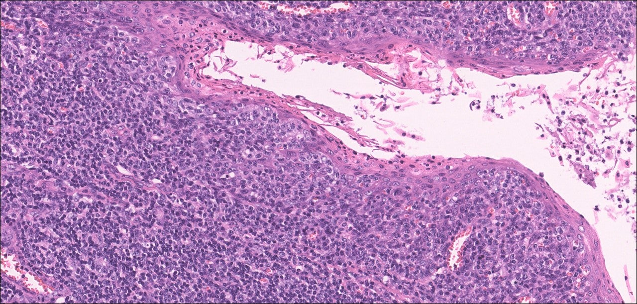 Tonsil – Normal Histology – NUS Pathweb :: NUS Pathweb
