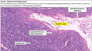 Tonsil – Normal Histology – NUS Pathweb :: NUS Pathweb