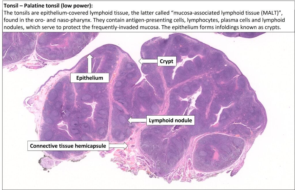 Tonsil – Normal Histology – NUS Pathweb :: NUS Pathweb
