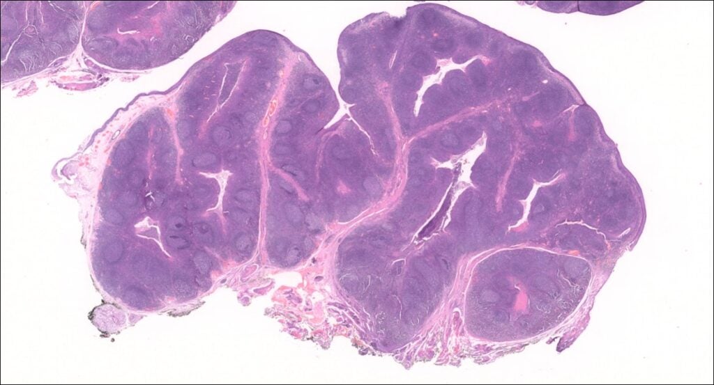 Tonsil – Normal Histology – NUS Pathweb :: NUS Pathweb
