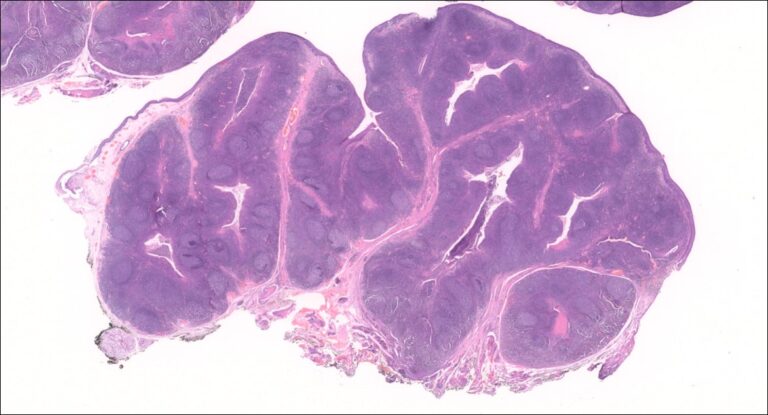 Tonsil – Normal Histology – NUS Pathweb :: NUS Pathweb