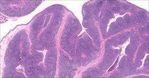 Tonsil – Normal Histology – NUS Pathweb :: NUS Pathweb