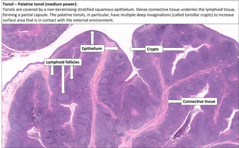 Tonsil – Normal Histology – NUS Pathweb :: NUS Pathweb