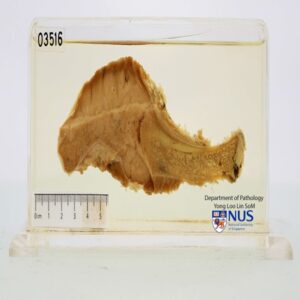 Test your diagnostic skills! – Musculoskeletal System – NUS Pathweb ...