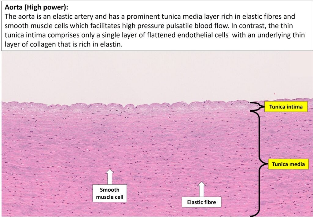 Blood vessels – Normal Histology – NUS Pathweb :: NUS Pathweb