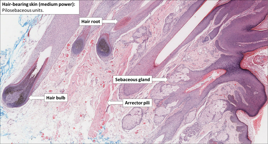 Skin – Normal Histology – NUS Pathweb :: NUS Pathweb