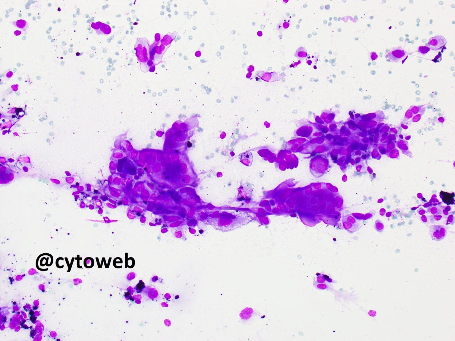 Mystery cases – EUS-FNA 6 – NUS Pathweb :: NUS Pathweb