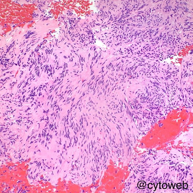 Mystery cases – EUS-FNA 2 – NUS Pathweb :: NUS Pathweb