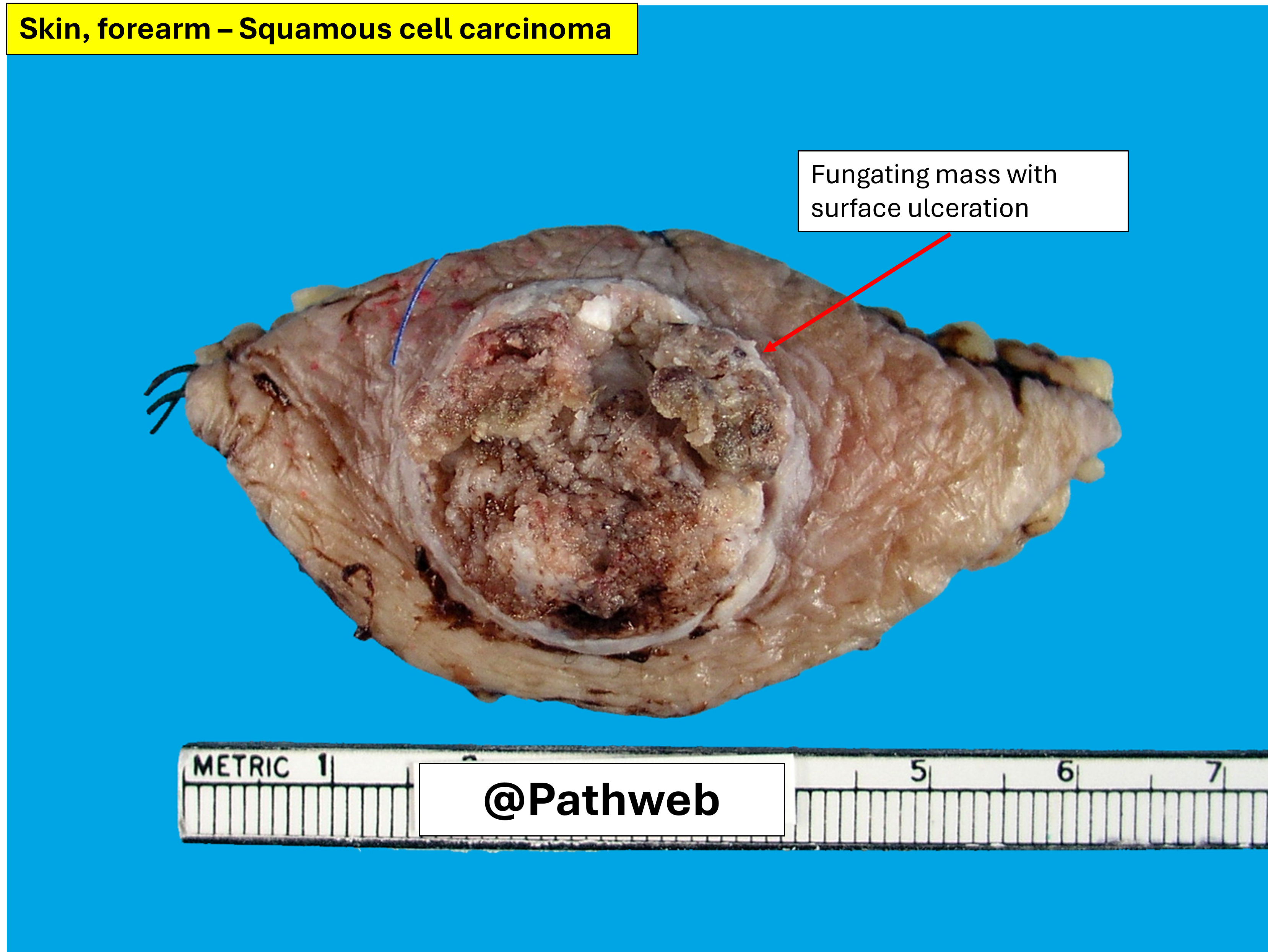 TYDS Gross Case 23 – NUS Pathweb :: NUS Pathweb