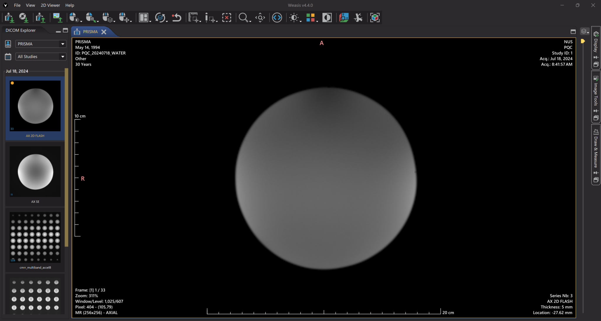 Weasis User Guide - NUS - TMR