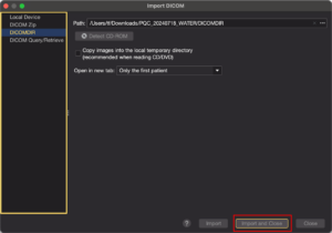 Weasis User Guide - NUS - TMR