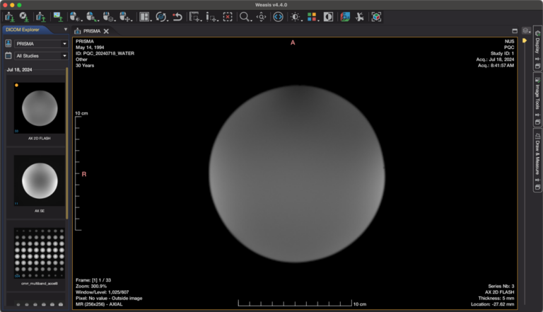 Weasis User Guide - NUS - TMR