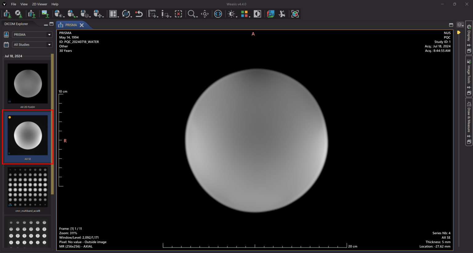 Weasis User Guide - NUS - TMR