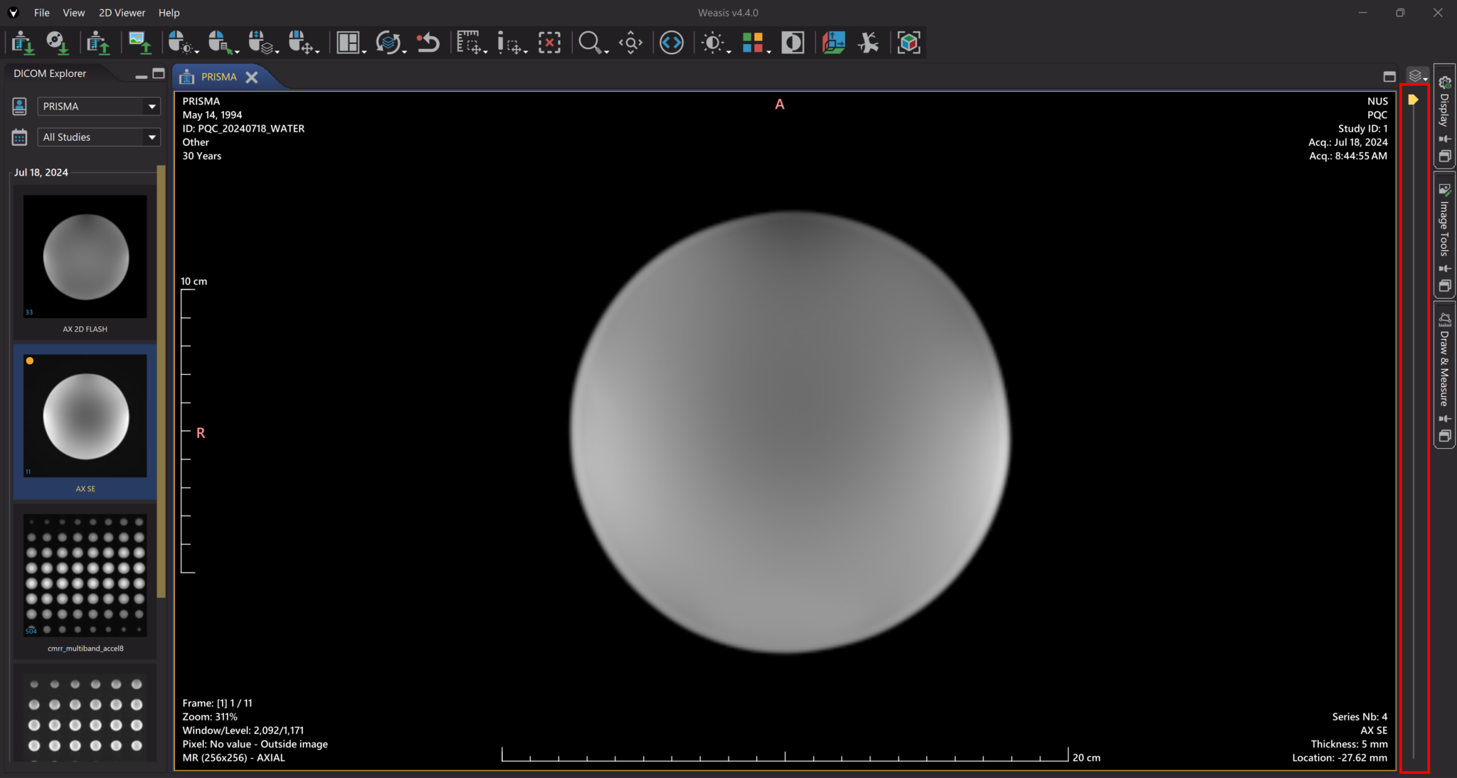 Weasis User Guide - NUS - TMR