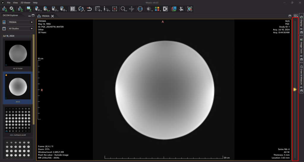Weasis User Guide - NUS - TMR