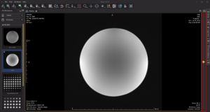 Weasis User Guide - NUS - TMR