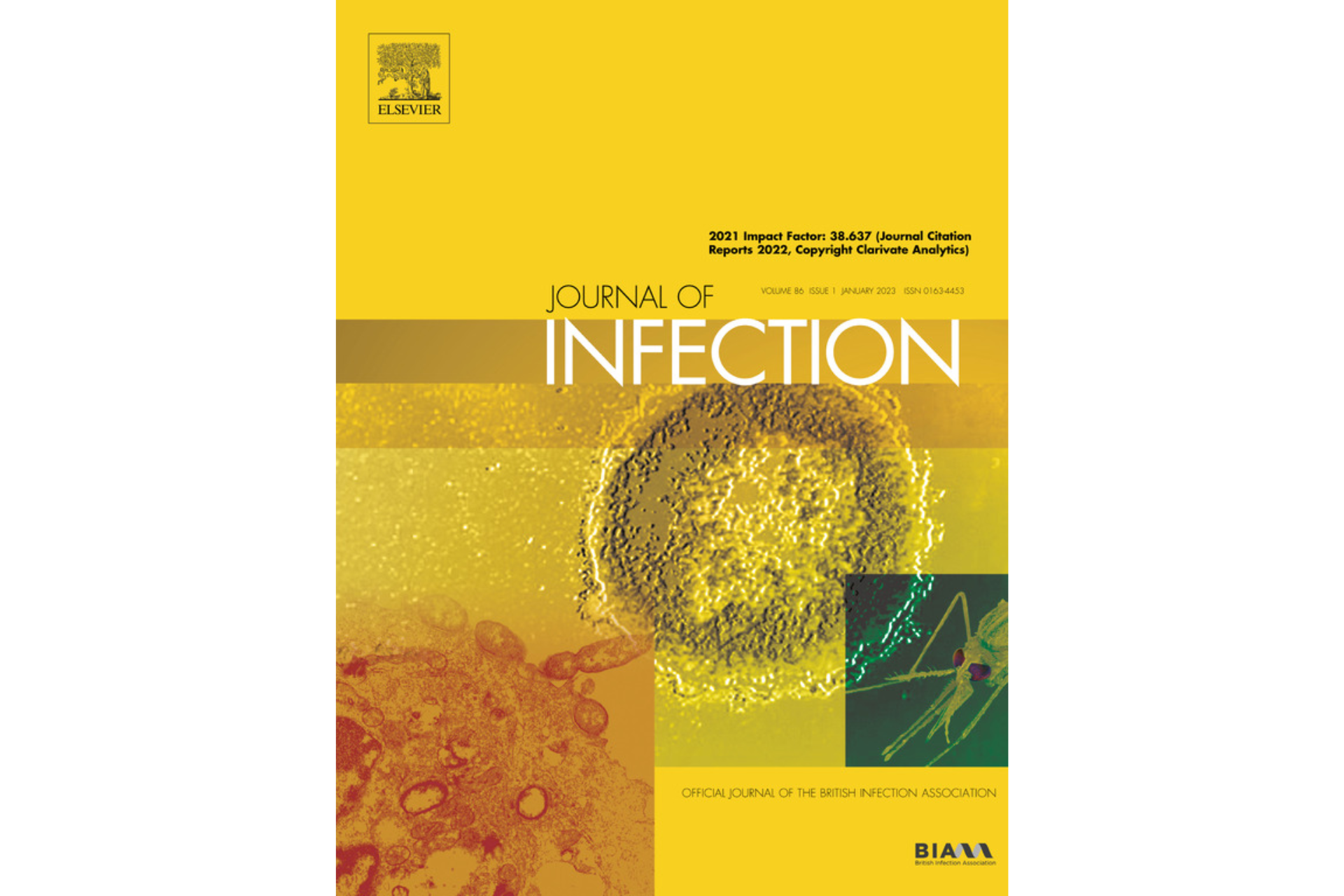Early seasonal coronavirus seroconversion did not produce cross ...